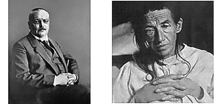 The History of Alzheimer’s Disease - Memory Assessment